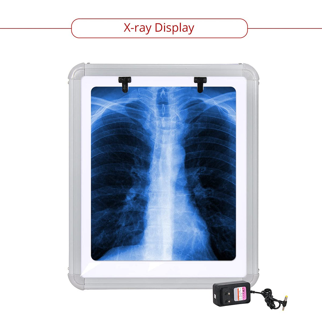 LED X-Ray Film Viewer Box – scimedstore